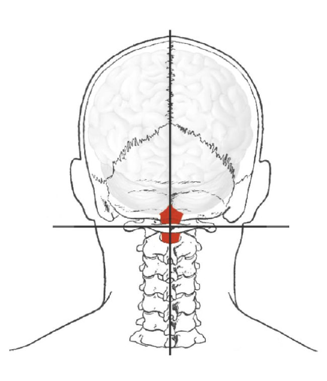 Spinal Alignment - Healthful Chiropractic - Upper Cervical North Dallas
